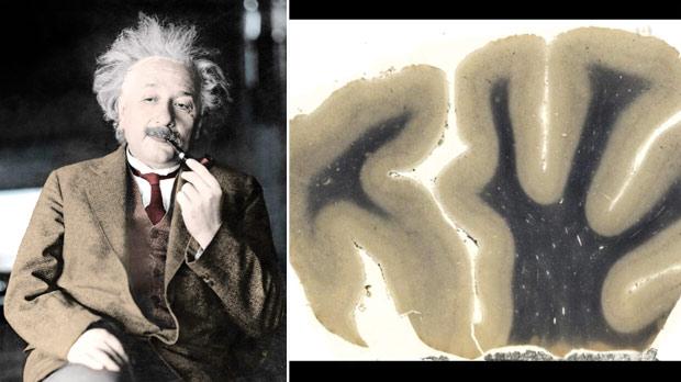 Einstein’s brain in your hand