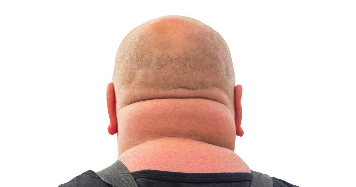 What your neck size reveals about your health