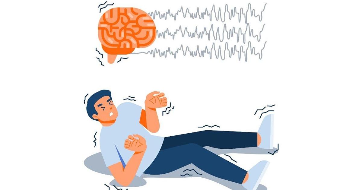 Curiosities: The brain’s electrical storms