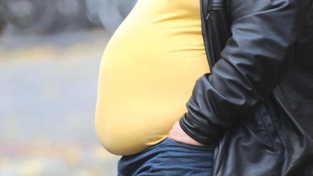 Scientists find how "obesity gene" makes people fat