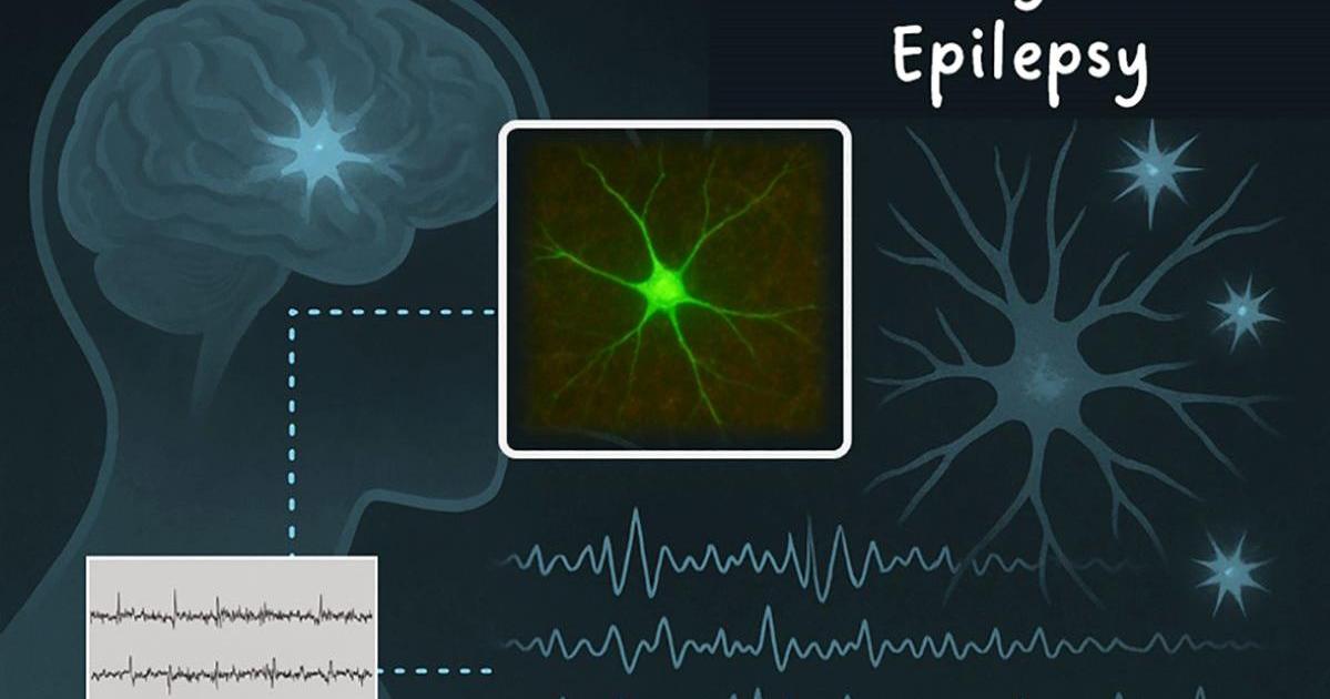 Studying how specialised brain cells influence epilepsy