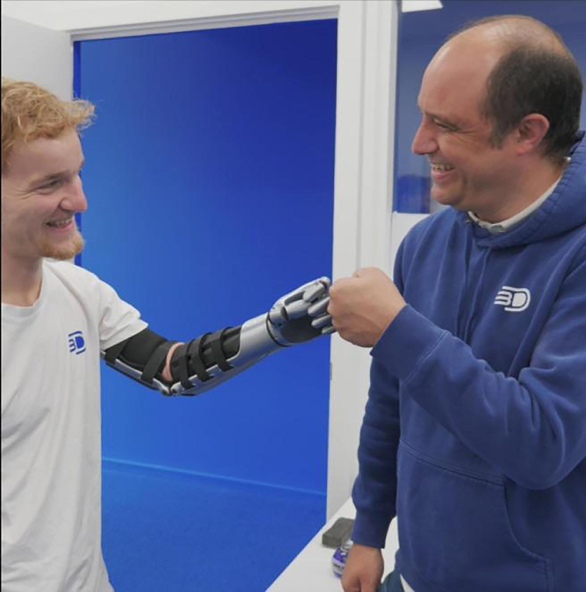 Born without a forearm, engineer creates life-changing prosthetics