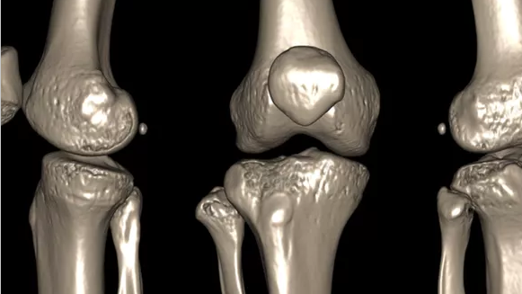 What makes joints pop and crack and is it a sign of disease?